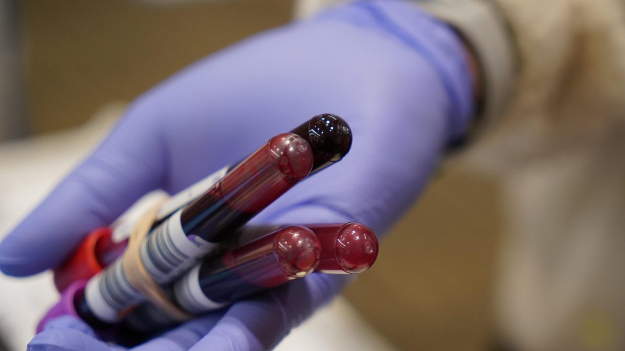 NorCal Hospitals Help with National Blood Shortage | Vitals