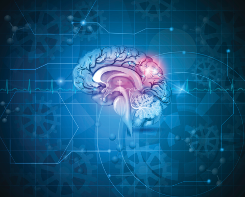 New Technology May Advance the Future of Stroke Care | Vitals