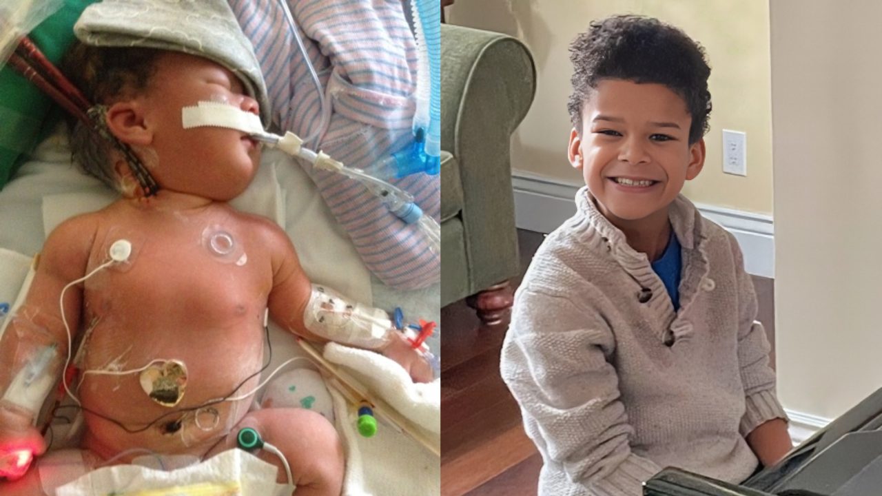 What's ECMO? Boy's Story Illustrates 'Ultimate Life-Saving Tool' | Vitals