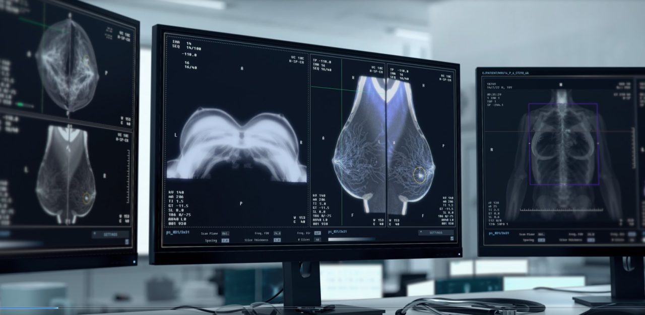 Health Systems Redefining Modern Breast Cancer Care | Vitals